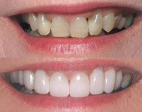 Pan Am Dental: Services